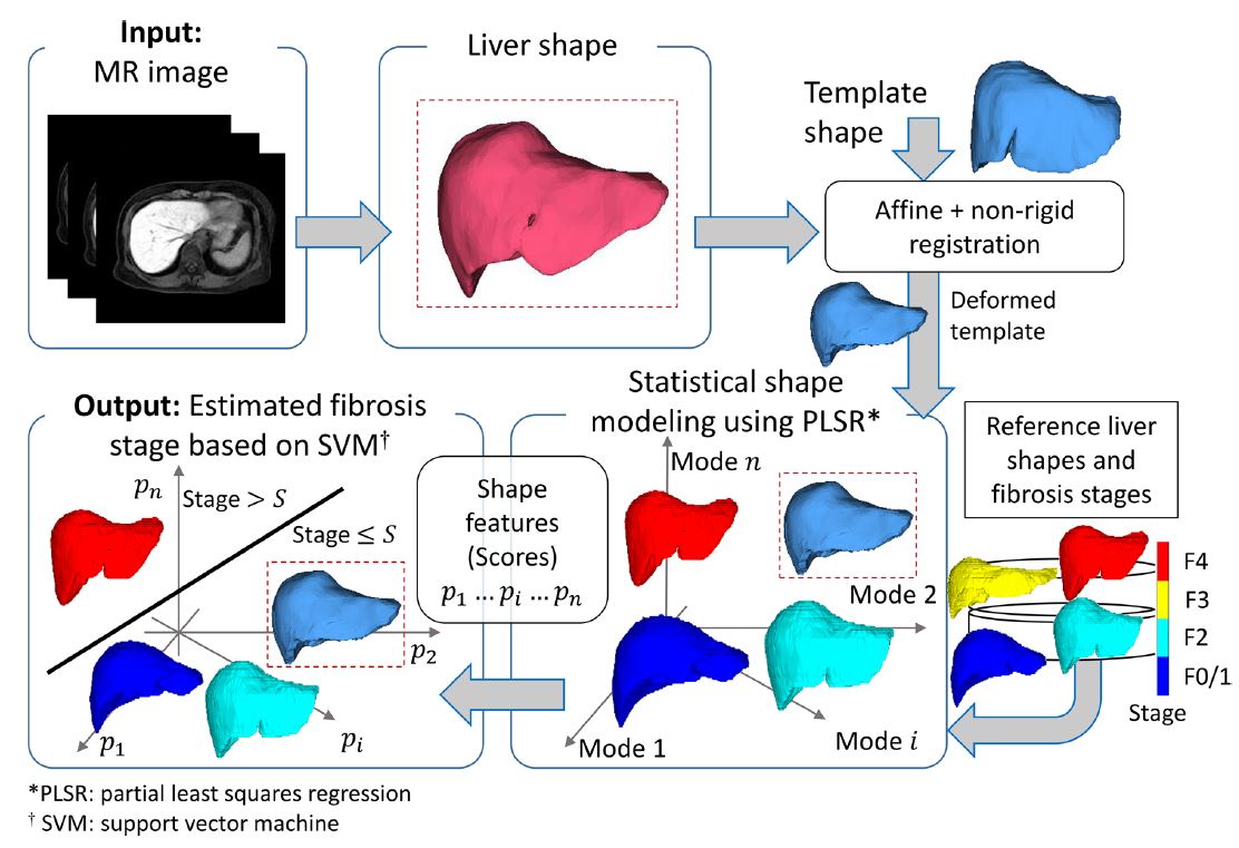 Liver Shape Analysis Using Partial Least Squares Regression Based Statistical Shape Model