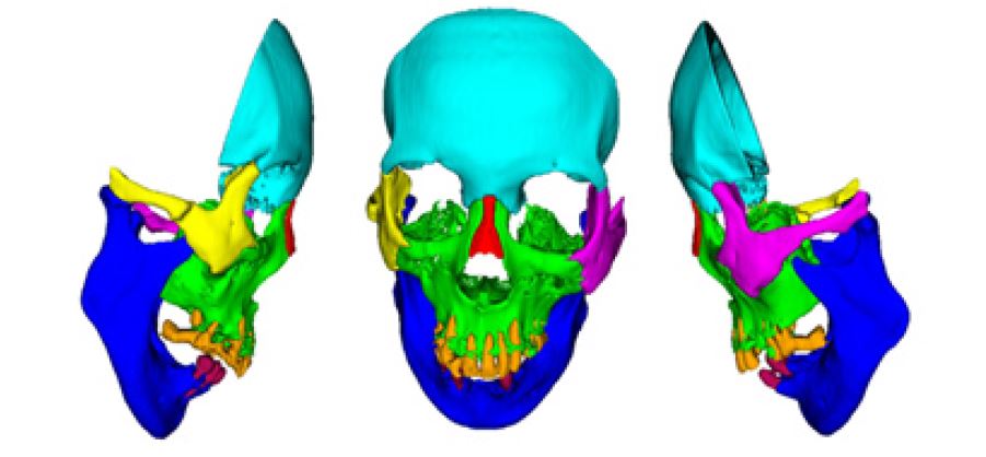 Deep Learning Based Automatic Facial Bone Segmentation Using A Two